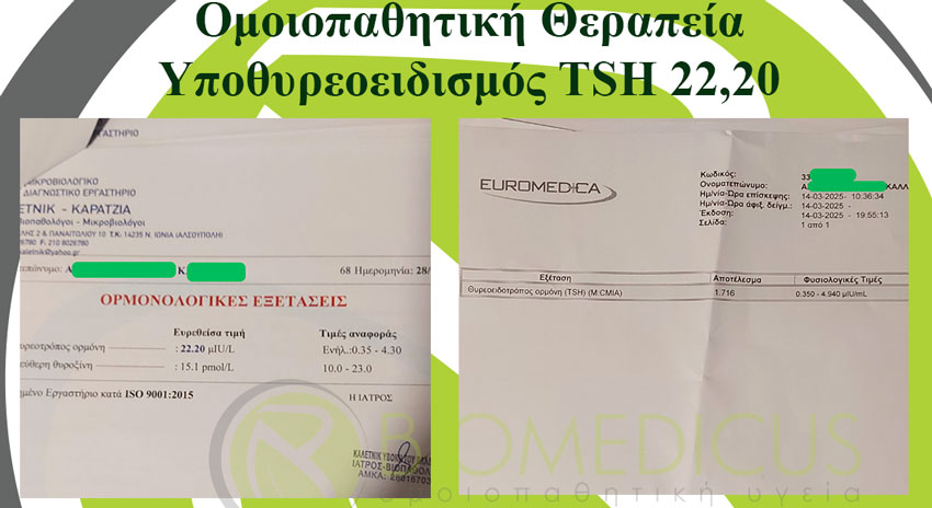 Θεραπεία Ασθενούς με Υποθυρεοειδισμό TSH 22,20 – Biomedicus